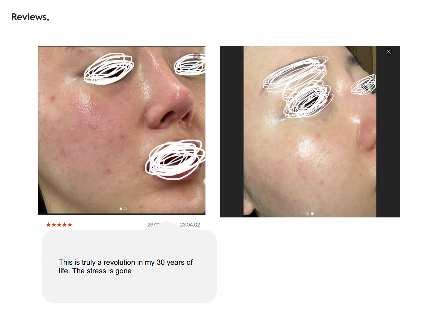 [PURCELL] PIXCELL BIOM™ AFTER LASER REBOOTING CREAM (50ml) - Raan Medi
